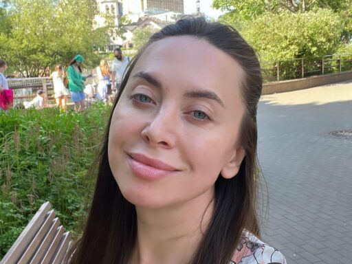 Сестра Жанны Фриске изменила внешность: кадры после шестичасовой операции - ACA.RU